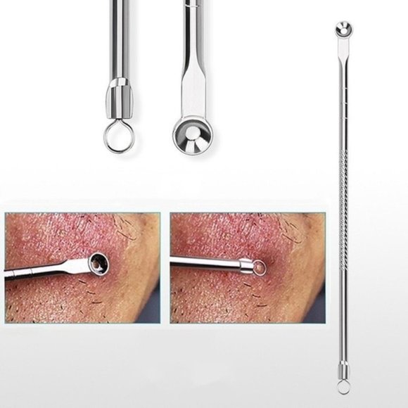 Makeup | 5 Pcs Set Blackhead Whitehead Pimple Removal Comedone Acne ...